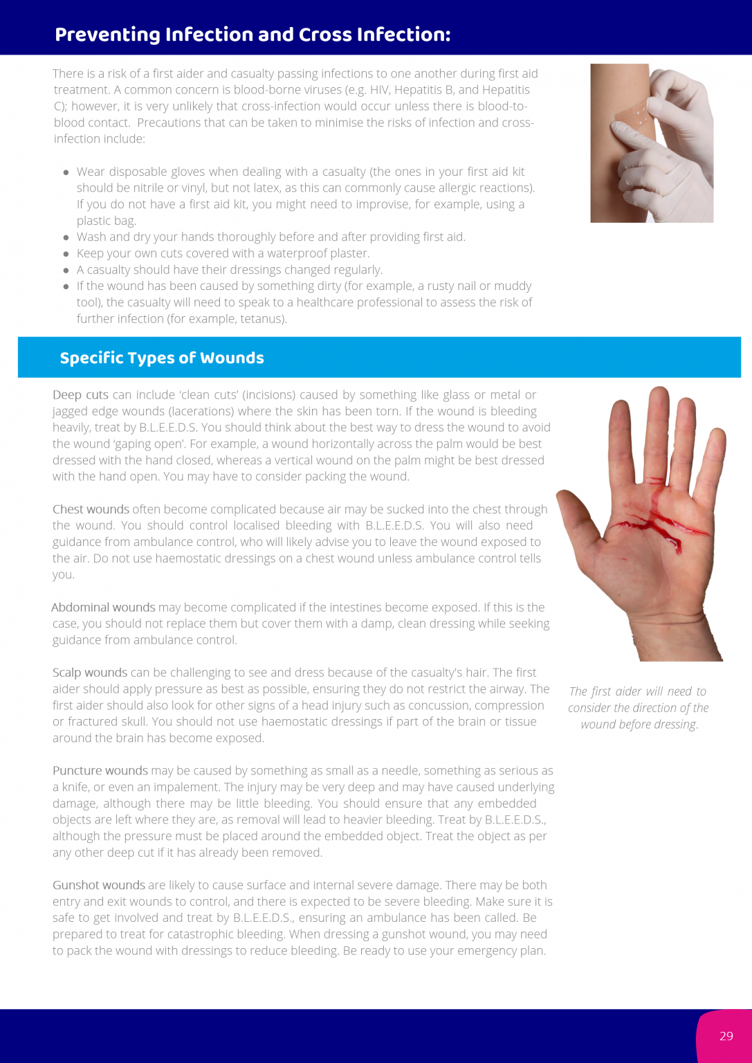 HUB: Bleeding Wounds Guidance Update | SkillBase First Aid